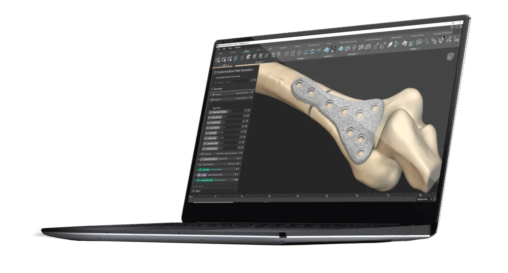 SOLIDWORKS Biomedical Innovation in Medical Design